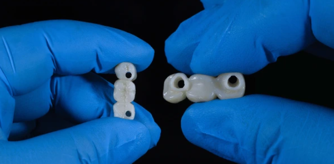 Clinician's Guide to Multi-Unit Abutments | Alfa Gate 2025 Standards ...