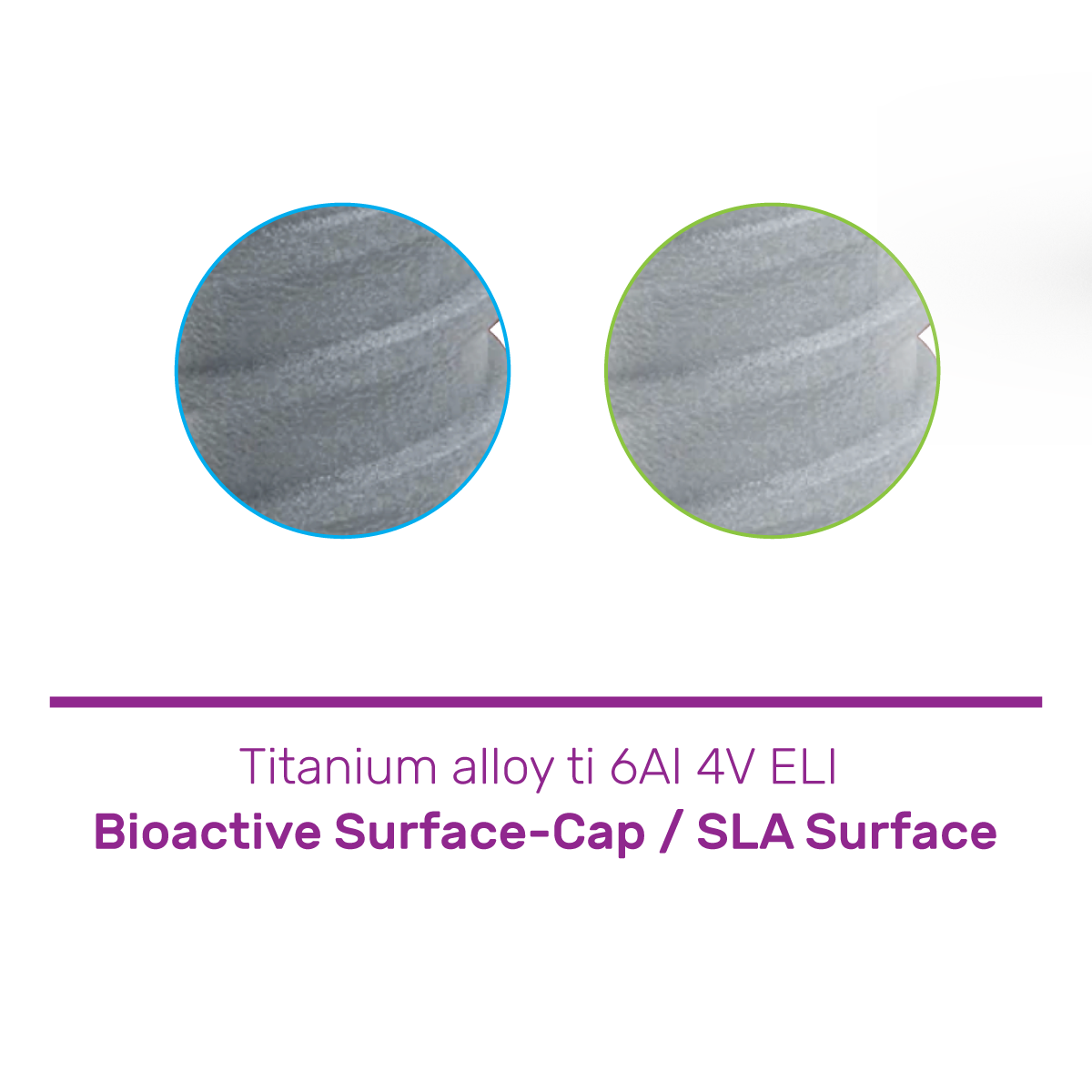 S-LINE DENTAL IMPLANT - Bio Active / SLA Surface. (S-L) – alfa-gate